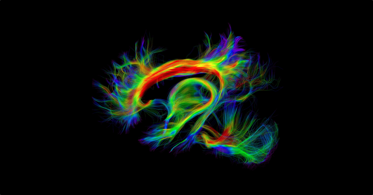 Articles - BrainArt.fr